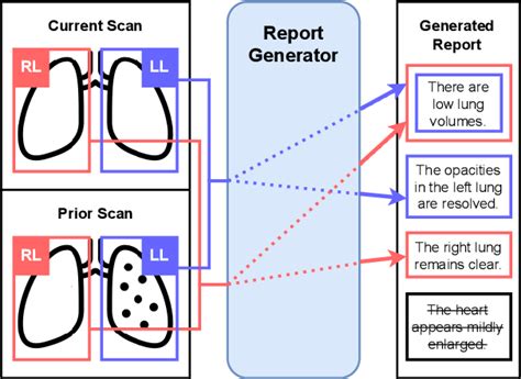 Controllable Chest X Ray Report Generation From Longitudinal Representations