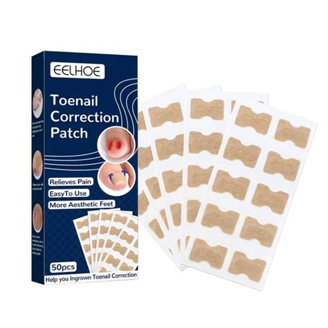 Ingrown Toenail Correction Patch Ingrown Toenail Corrector Treatments