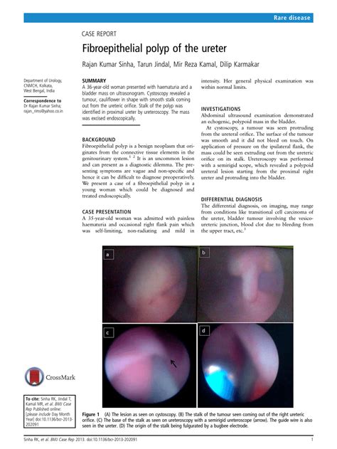 Pdf Fibroepithelial Polyp Of The Ureter