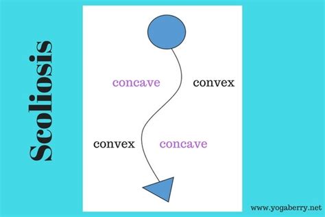 Understanding Your Scoliosis Curve Yogaberry