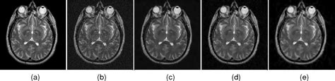 Figure 2 From Mri Denoising Using Sparse Based Curvelet Transform With