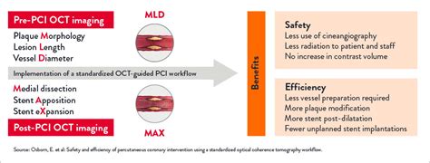 Intravascular Imaging Optical Coherence Tomography Oct Lightlab