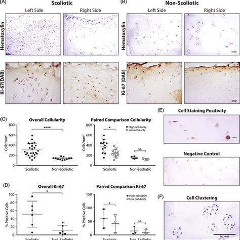 Lenke Classification System For Scoliositic Spine Curvatures Download