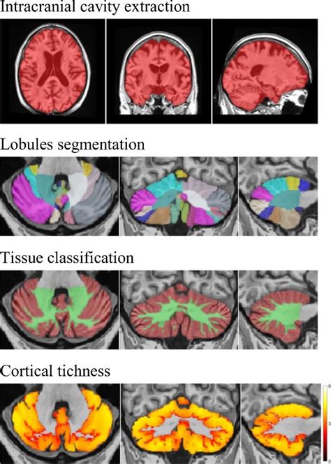 Processing Pipeline Preprocessing Steps Subsequently The Tissue
