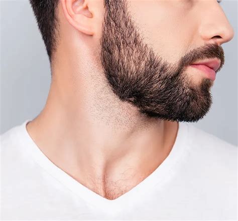 Facial Hair Perfection With Dr Diep Leading In Facial Hair Transplants
