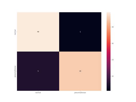 Pneumothorax Binary Classification With Pytorch Using Oversampling