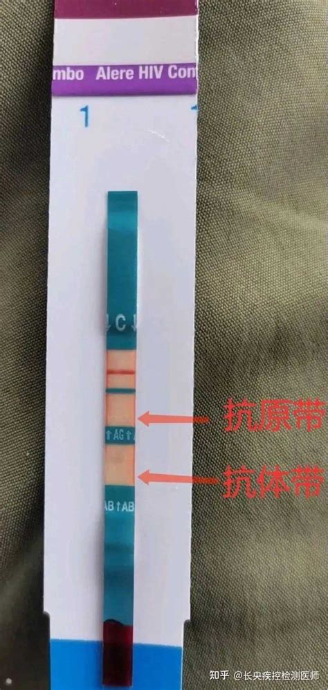 Hiv试纸中重组抗原是否具有免疫原性hiv试纸中重组抗原进入人体是否反应产生抗体？ 知乎