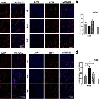 Sex Difference In Neuroprotection Through Neuroglial Proliferative Download Scientific Diagram