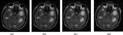 compressive sensing mri using dual tree complex wavelet transform with