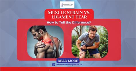 Muscle Strain Vs Ligament Tear How To Tell The Difference