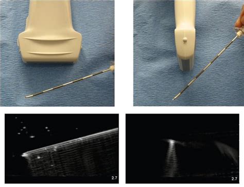 Obstetric Anesthesia Ultrasonography Basics Transducer Structures