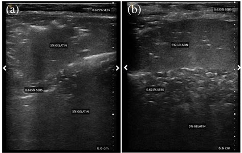 Ultrasound Images Of The Final Phantom As Viewed From The Top With Download Scientific Diagram