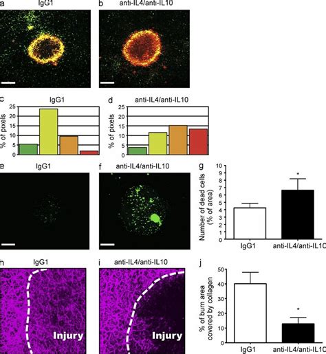 Ccr2⁺ Monocytes Transition Into Ccr2⁺cx3cr1⁺ Monocytes At A Site Of