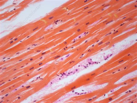Human Cardiac Muscle Light Micrograph Stock Image C021 0475 Science Photo Library
