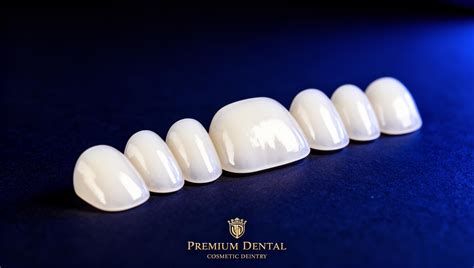 Dental Veneers And Dental Laminates In Concord Ca Blue Diamond