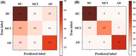 Triple Classification Result For 240 Subjects With 10‐fold
