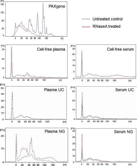 Small RNA Profiles Extracted From Intracellular Cell Free And Exosomal Download Scientific