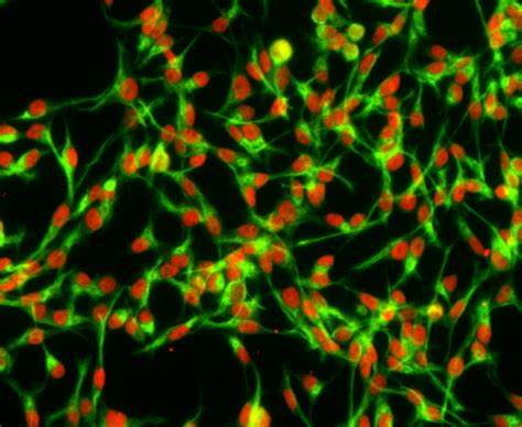 Rhb A Neural Stem Cell Culture And Differentiation Medium