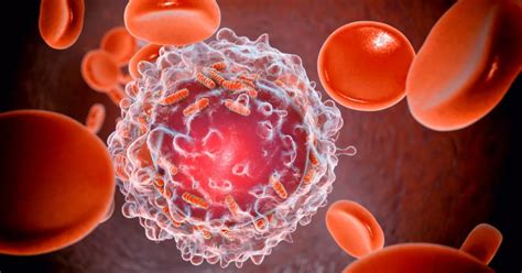 Symptoms Of Leukaemia To Watch Out For As Worrying Research Shows Brits Dont Know Signs