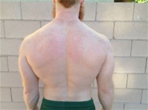 Scapular Positioning Yuri Marmerstein