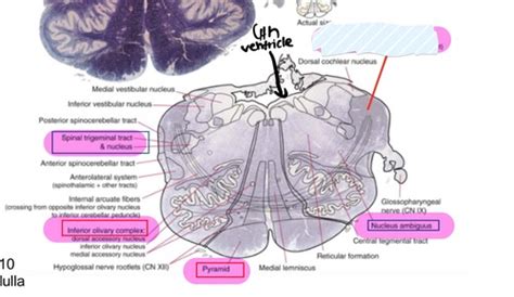 Brainstem Lecture Flashcards Quizlet
