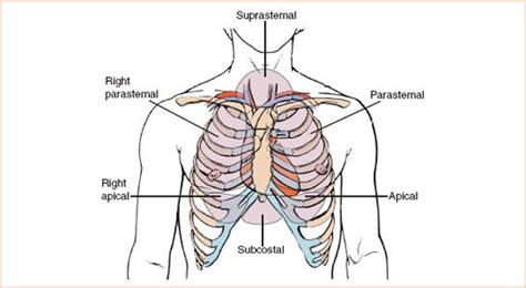 Critical Care Echocardiography Radiology Key