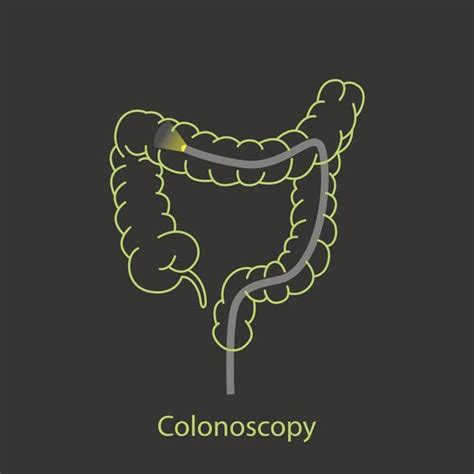 151 Hilarious Colonoscopy Puns That Will Make You Laugh Meredith Plays
