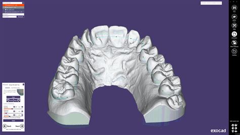 Bite Splint Module Exocad