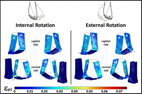 Internal And External Rotation First Principal Strain Distribution Of Download Scientific