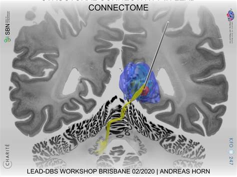 Structural Connectomics Dmri Ppt