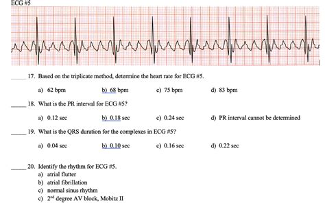 Solved Ecg 5 алллллллллллллллоо 17 Based On The
