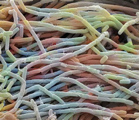 Bacillus Megaterium Bacterial Colony Stock Image F0431131 Science Photo Library