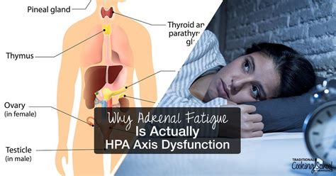 Why Adrenal Fatigue Is Actually Hpa Axis Dysfunction Artofit