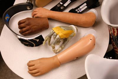 Prosthetic Limb Control Howstuffworks