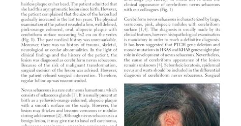 Mehmet Eren Yuksel Cerebriform Nevus Sebaceous