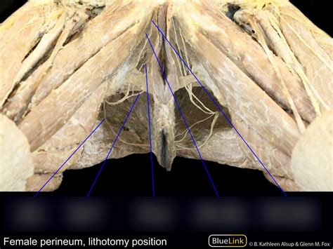 Female Perineum Lithotomy Position Diagram Quizlet