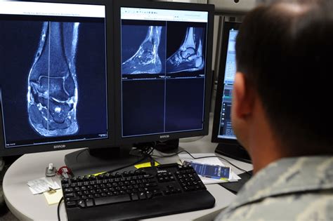 Philips And Nuance Partner In Ai To Enhance Radiology Algorithm X Lab