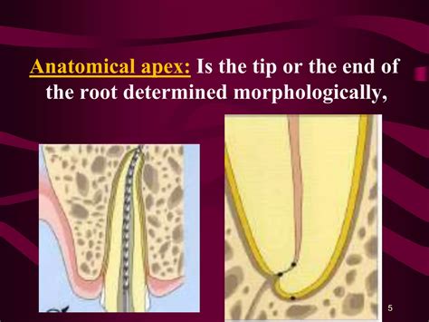 Working Length Estimation In Endodontic Pptx