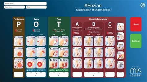 Enzian Classification Mis By Ariel Aljohn Coching