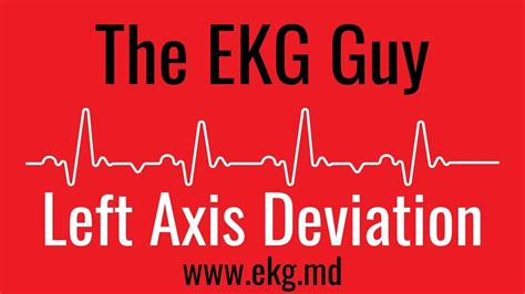Left Axis Deviation On Ekg Ecg L The Ekg Guy Ekg Md Youtube