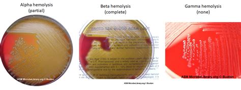 15 1 2 2 The Streptococci Biology Libretexts