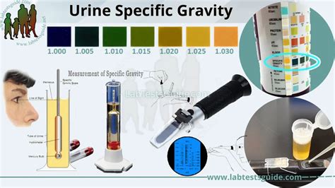 Urine Specific Gravity And Its Significance 57 Off