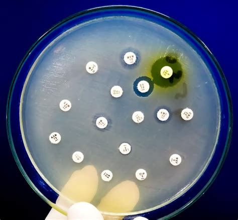 Premium Photo Antimicrobial Susceptibility Testing In Petri Dish