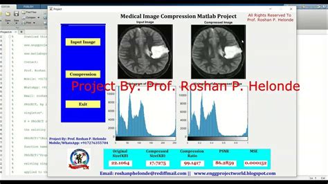 Medical Image Compression Using Matlab Source Code Image Compression Ieee Project Code Youtube