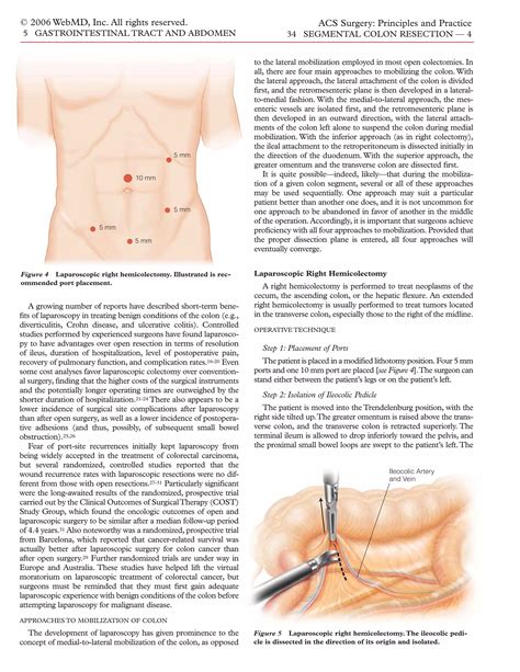 Acs0534 Segmental Colon Resection 2006 Pdf
