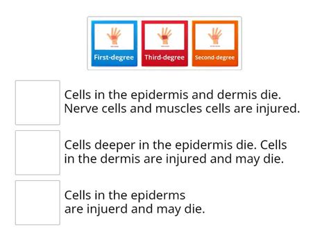 Classification Of Burns Match Up