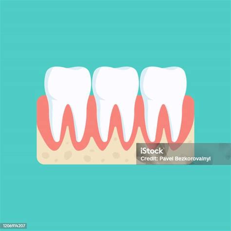 칫솔질과 미백 후 건강한 치아 소아 치과의 개념 벡터 일러스트레이션 건강 진단에 대한 스톡 벡터 아트 및 기타 이미지 건강 진단 건강관리와 의술 건강한 생활방식