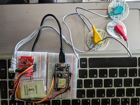 Ecg Monitoring System