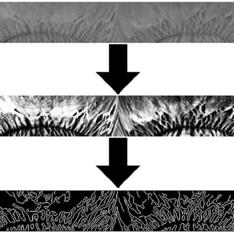 Normalized Image Enhancement And Edge Detection Process Then For