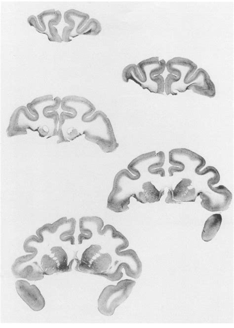 Figure 1 From Amygdalar Interaction With The Mediodorsal Nucleus Of The Thalamus And The
